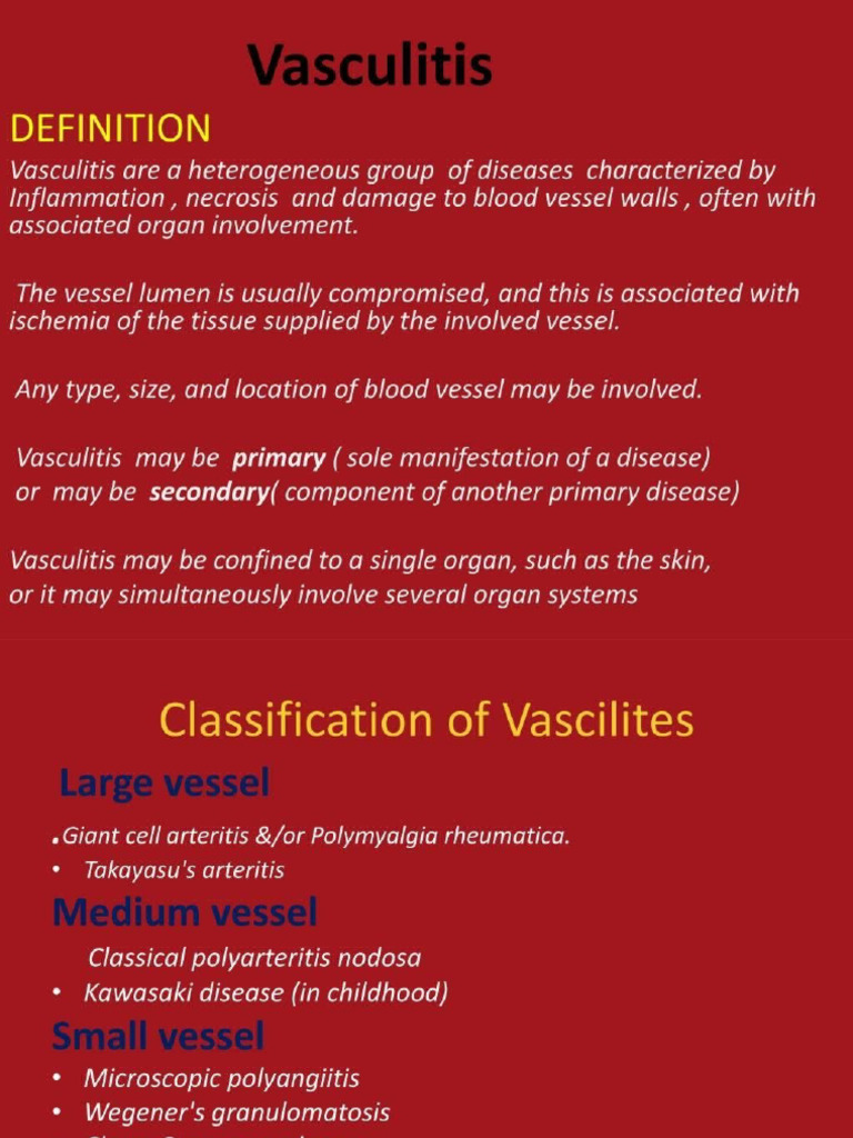 Lec.10 Vasculitis | PDF