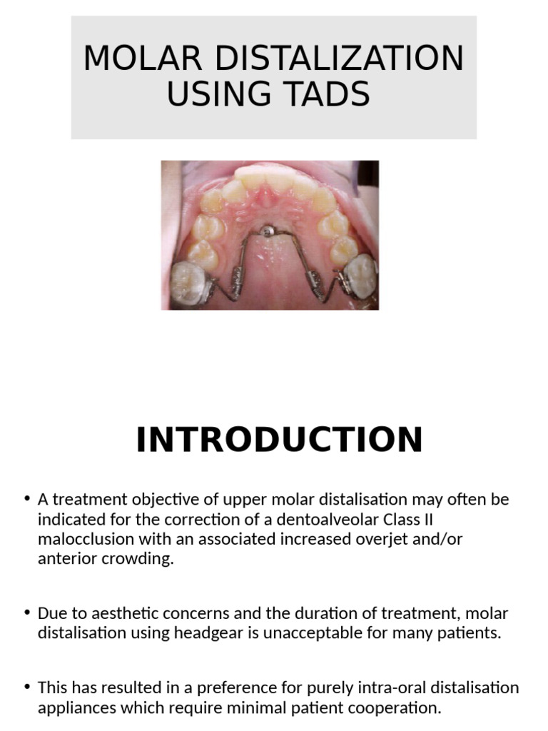 Molar Distalization Using TADS | PDF | Dental Implant | Orthodontics