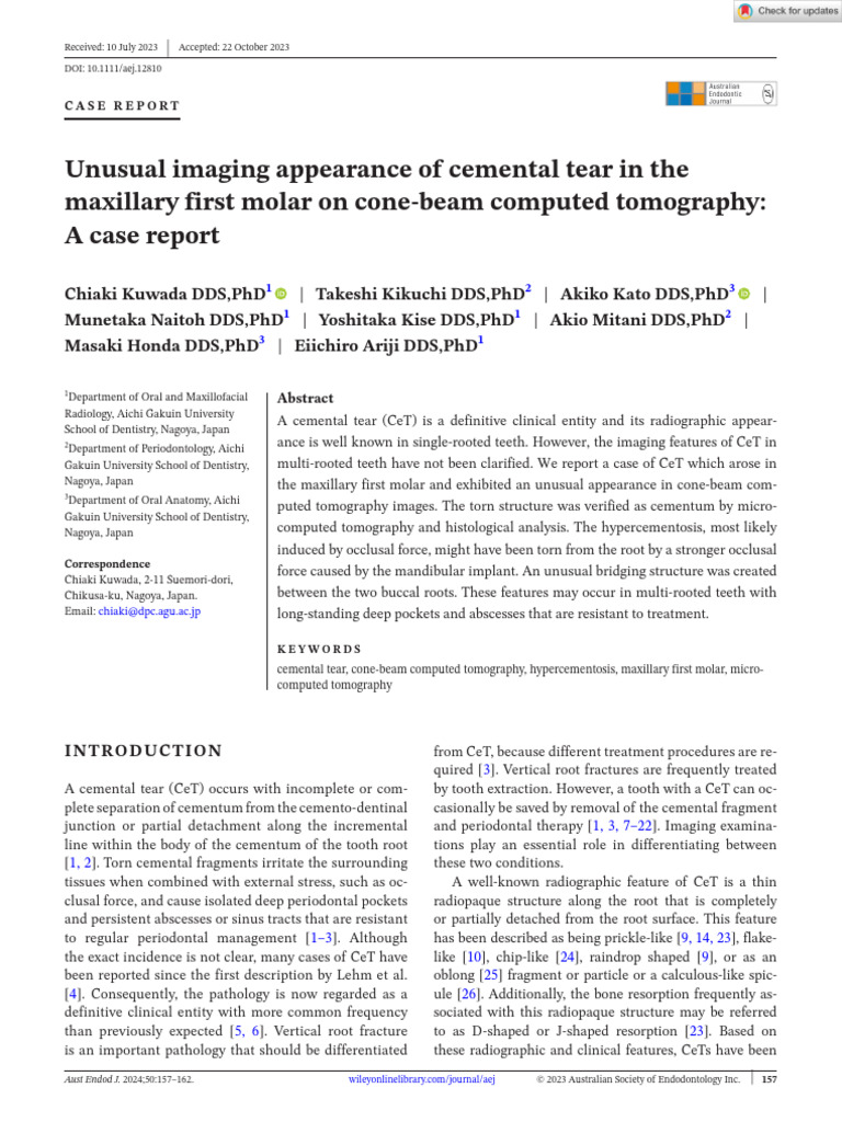 Aust Endodontic J - 2023 - Kuwada - Unusual Imaging Appearance of ...