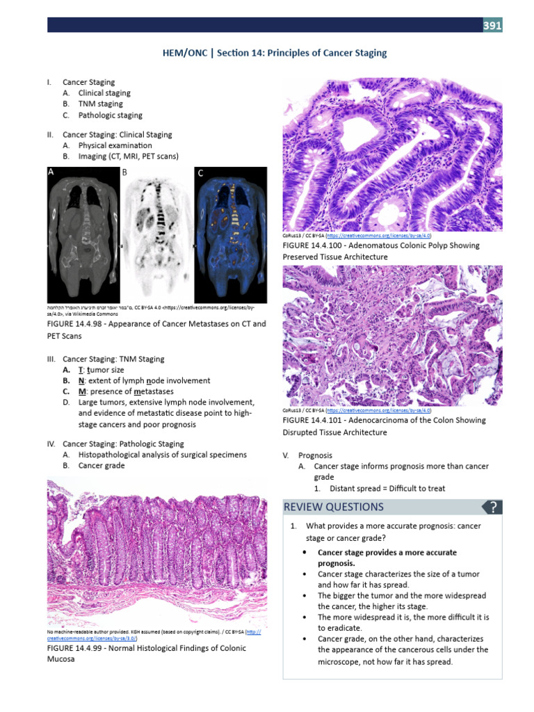 Section 14 – Principles of Cancer Staging | PDF | Cancer | Metastasis