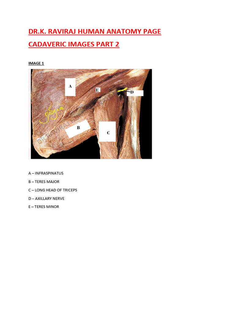 Cadaveric Image 2.PDF Version 1 | PDF