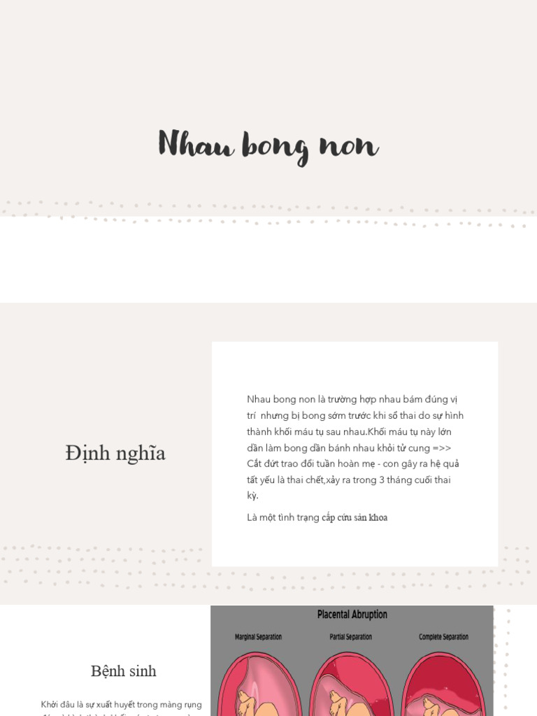 Presentation 3 | PDF