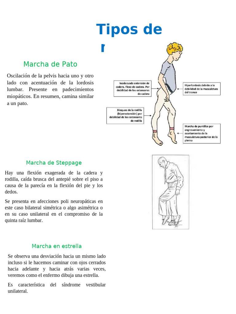 Tipos de marcha y sus características | PDF | Sistema ...