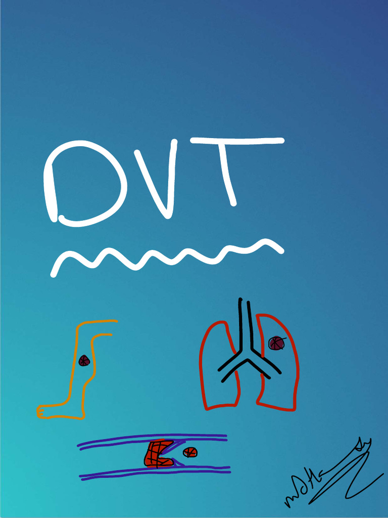 DVT Prophylaxis | PDF