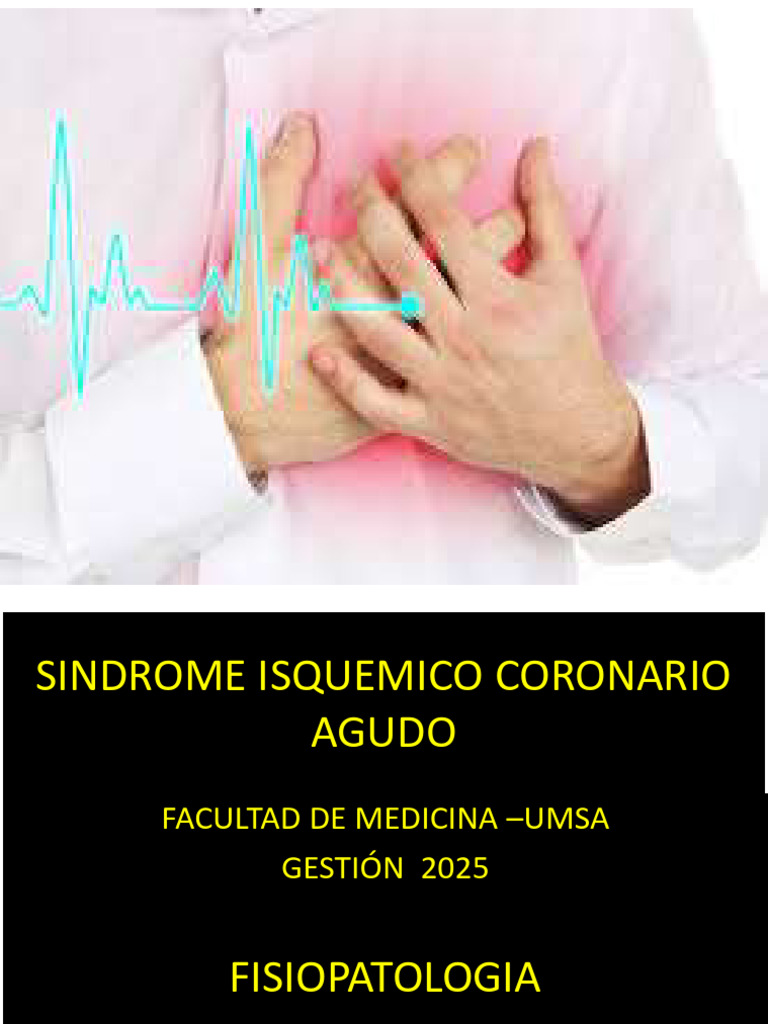 Síndrome Isquémico Coronario Agudo: Guía Completa | PDF | Ateroma ...