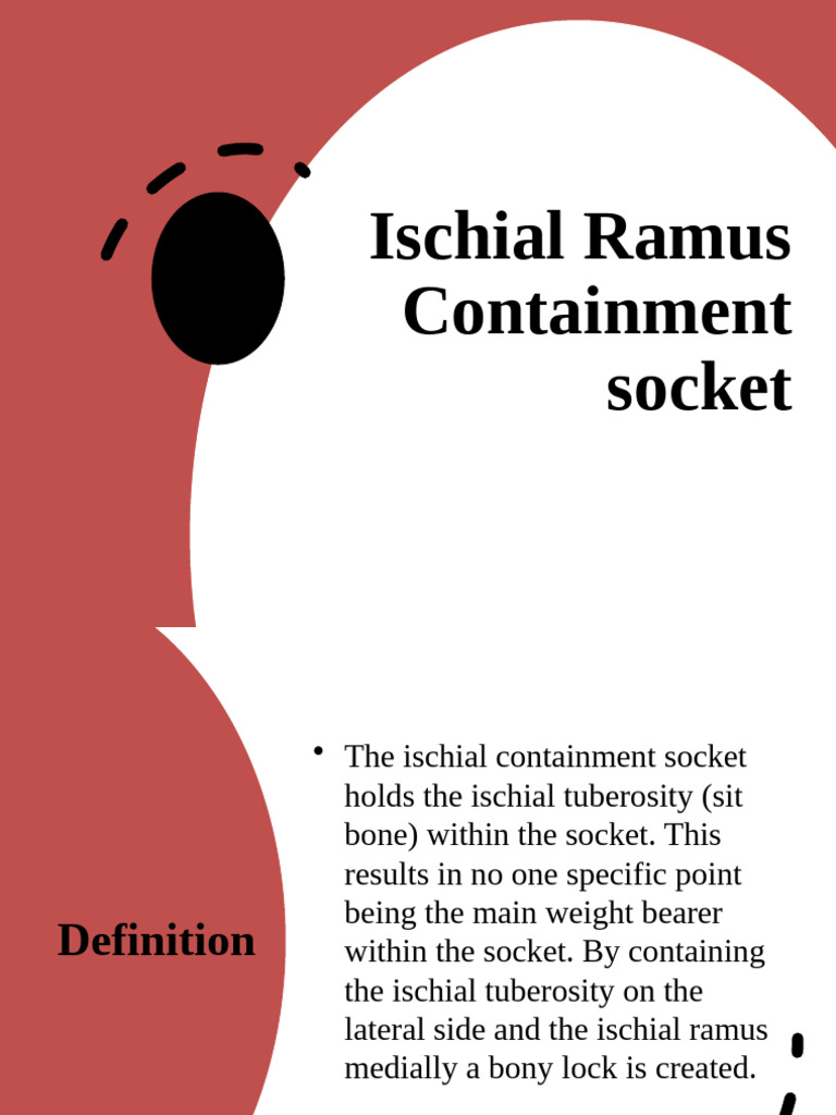 Ischial Containment Socket Overview | PDF | Amputation | Prosthesis
