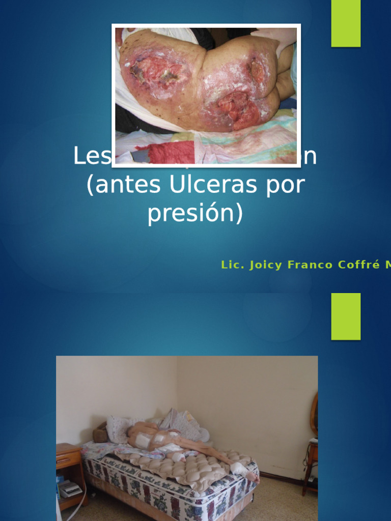 Piel y Lesiones Por Presion | PDF | Piel | Herida