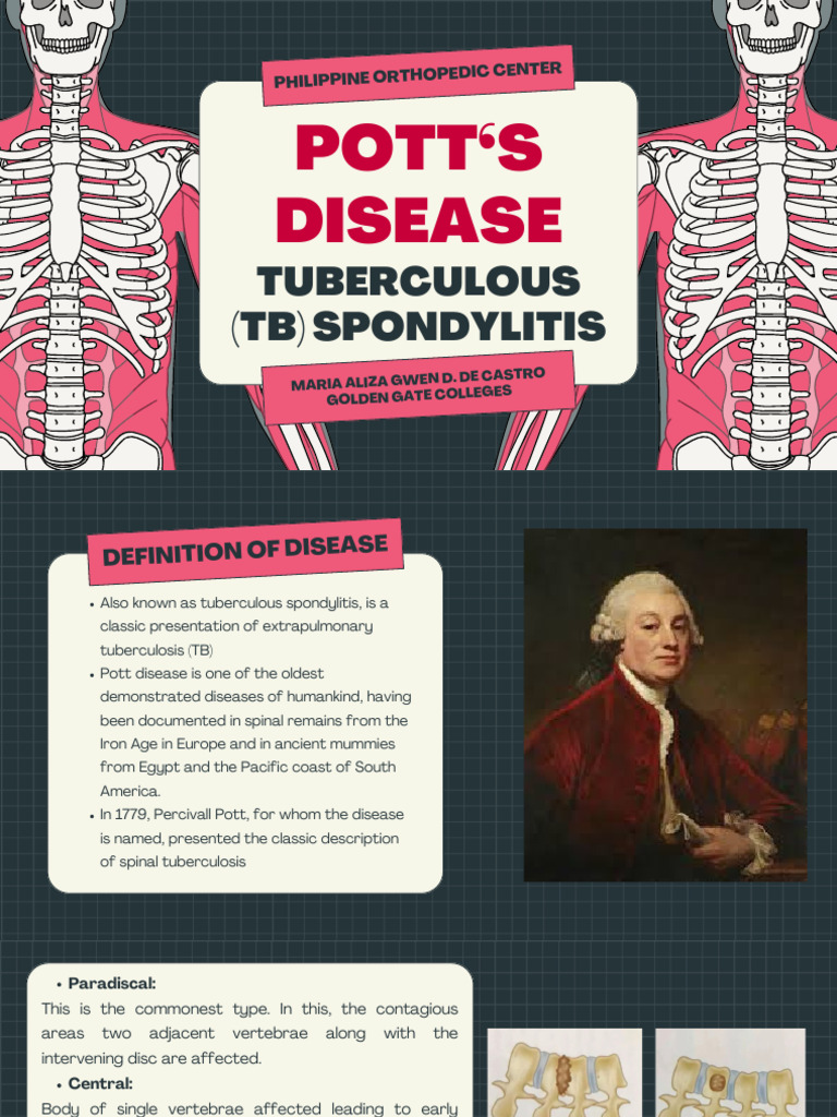 Pott Disease (Tuberculous (TB) Spondylitis) | PDF | Vertebra | Tuberculosis