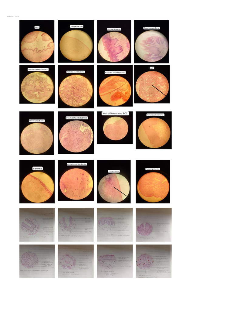 Oral Pathology | PDF