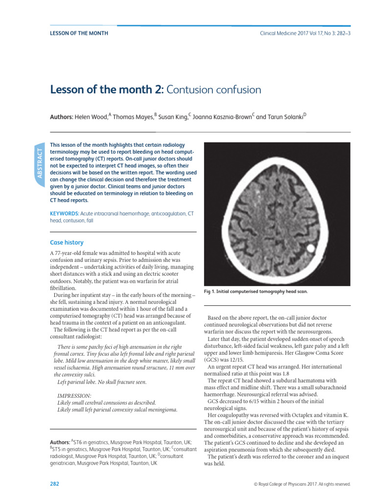 Lesson of The Month 2 Contusion Confusion 2017 Clinical Medicine | PDF ...