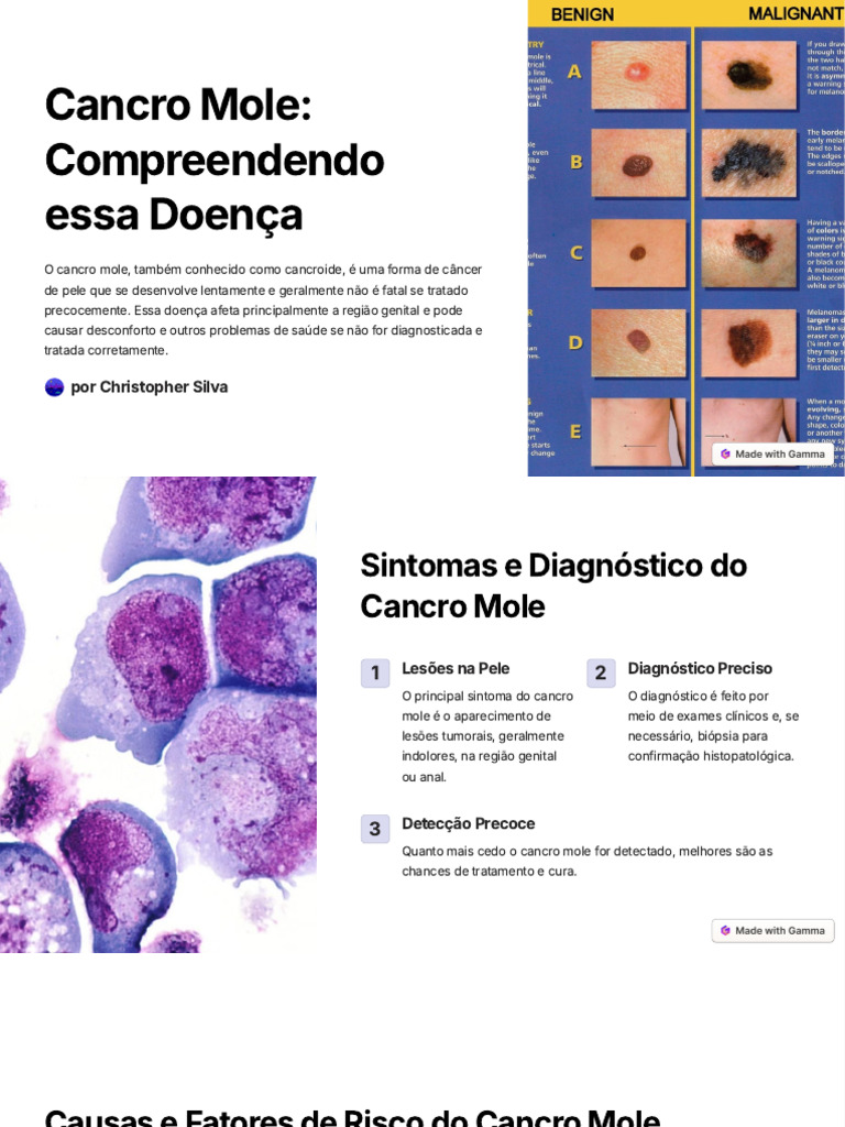 Tratamento e Prevenção do Cancro Mole | PDF | Câncer | Ciências da Saúde