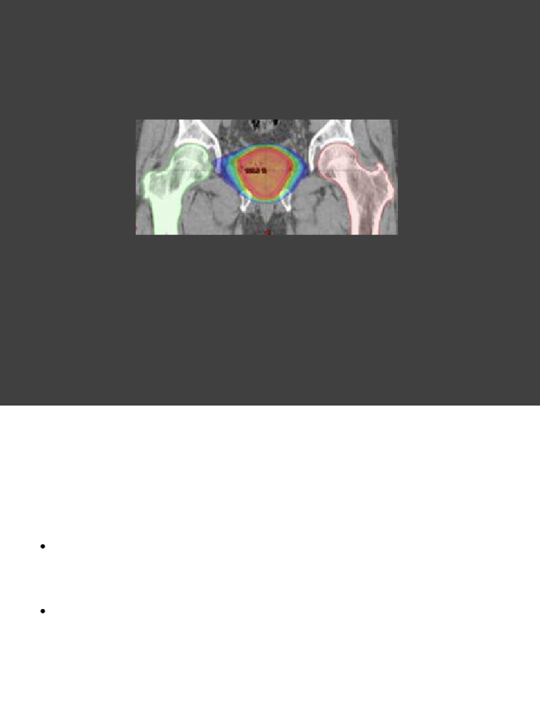 RTOG 0938 Protocol Overview for SBRT | PDF | Radiology | Nuclear Medicine