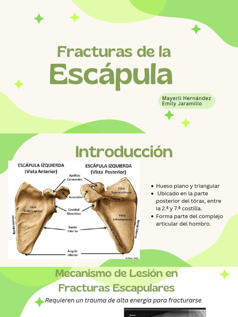 Fracturas de La Escápula | PDF | Tórax | Hombro