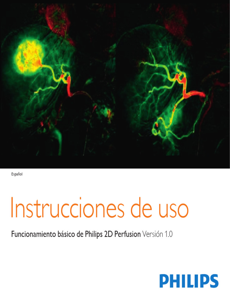 Instrucciones de Uso de 2D Perfusion | PDF | Software | Angiografía