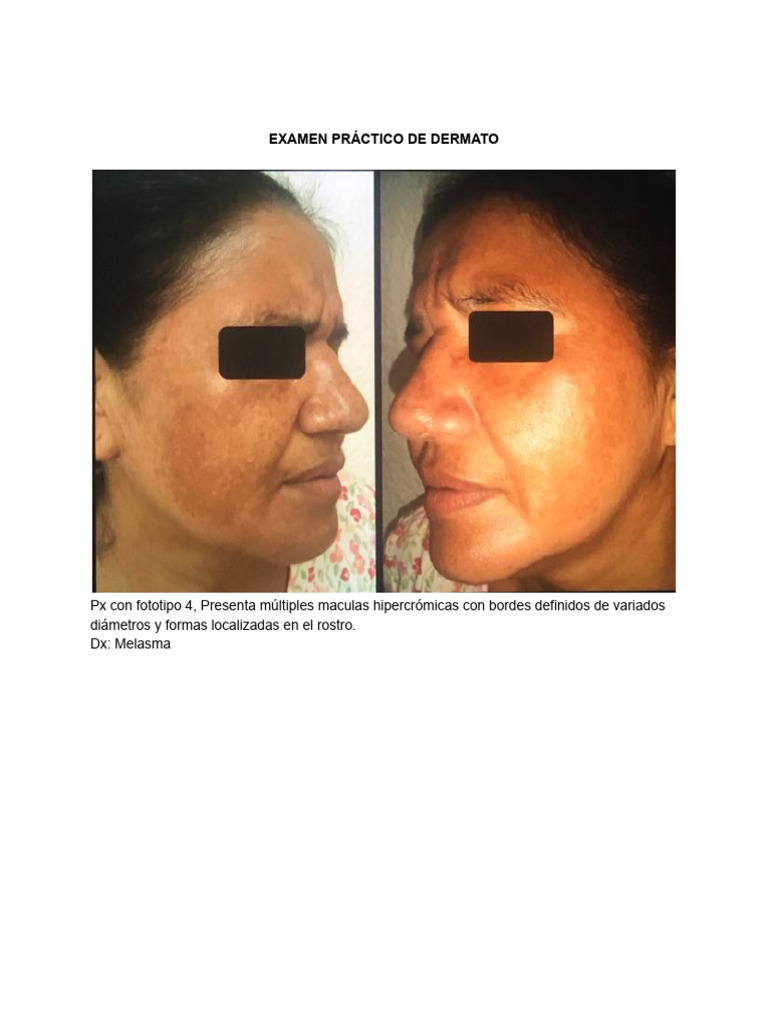 Examen Práctico de Dermato | PDF