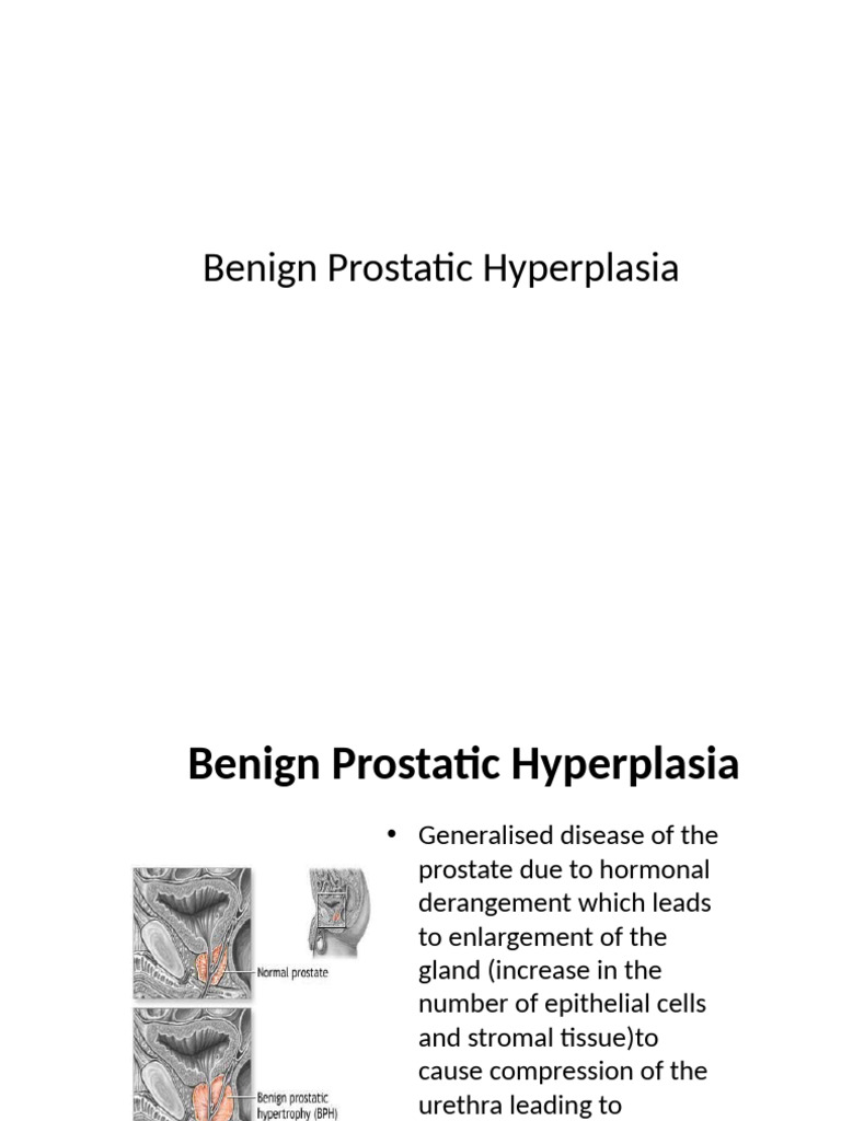 Benign Prostatic Hyperplasia | PDF | Prostate | Urinary Incontinence