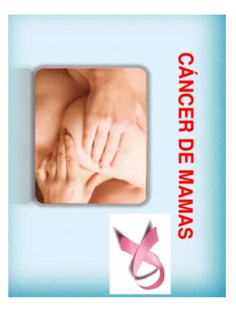 Cáncer de Mama 2 | PDF
