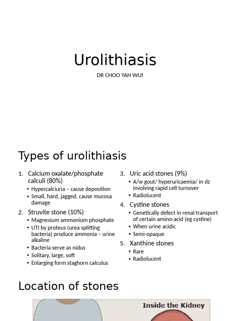 Urolithiasis 03072024 | PDF | Urology | Medical Specialties