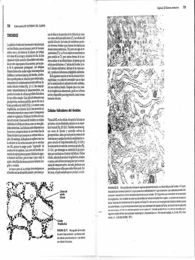 LEC HAM - tiroides | PDF