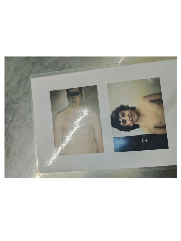 Genetic Charts Anat | PDF