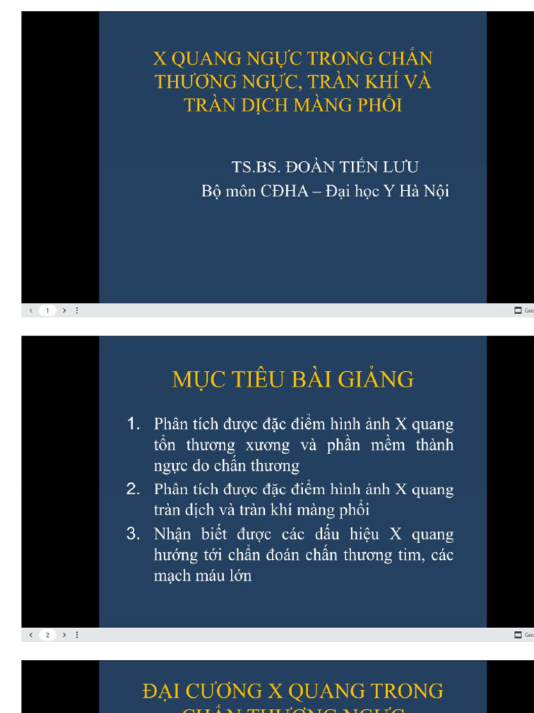 LEC5. S2.6 - Slide Lms | PDF