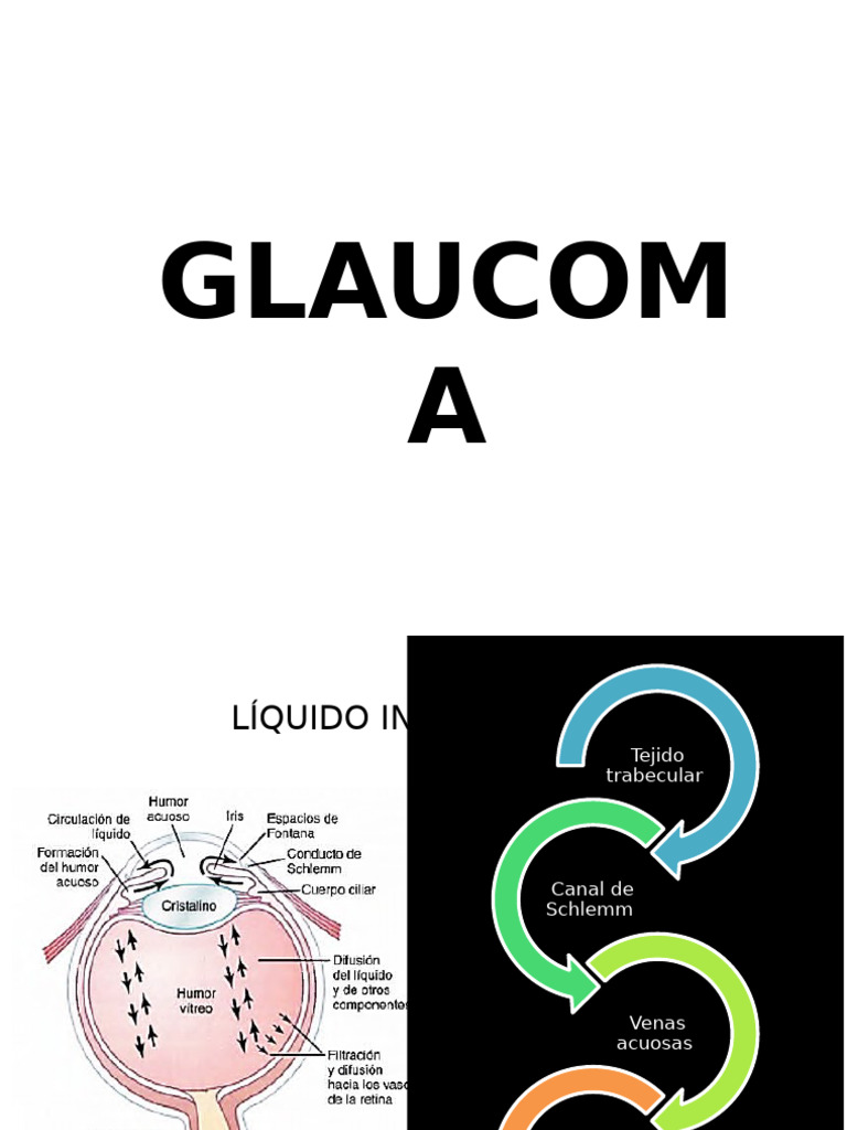 Glaucoma 2 | PDF | Glaucoma | Ojo humano