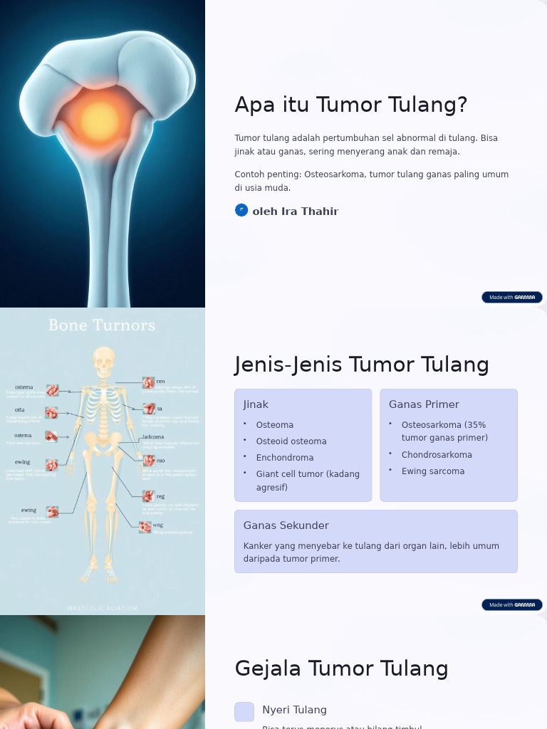 Apa Itu Tumor Tulang | PDF
