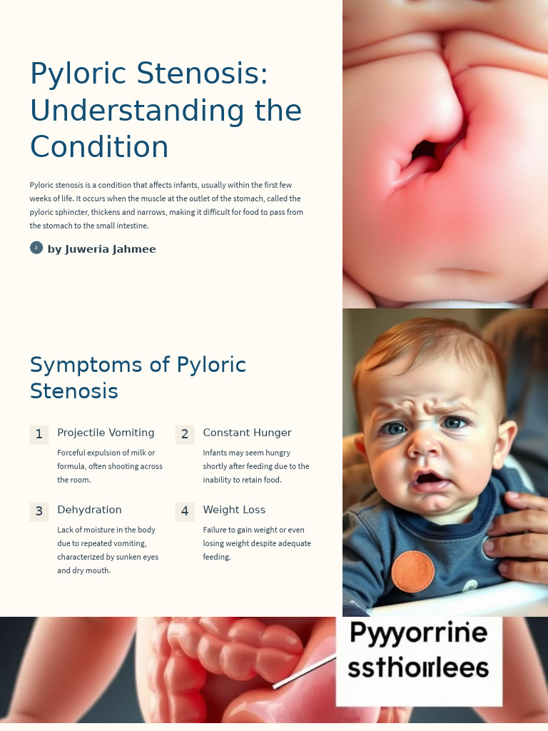 Pyloric-Stenosis-Understanding-the-Condition | PDF | Medical Specialties | Diseases And Disorders