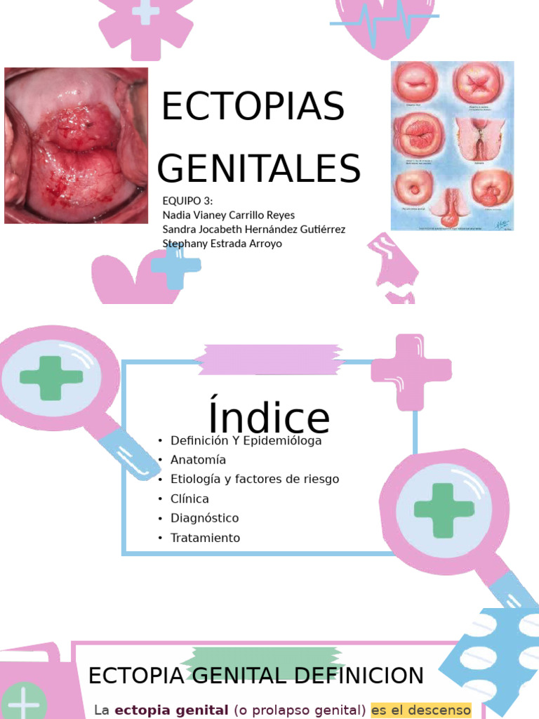 ECTOPIAS GENITALES | PDF | Pelvis | Especialidades Medicas