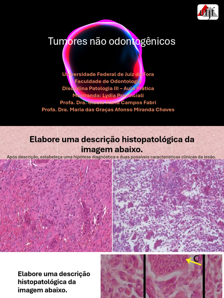 PDF - Tumores Na-O Odontoge-Nicos - Aula Pra-Tica | PDF | Cirurgia oral e maxilofacial ...
