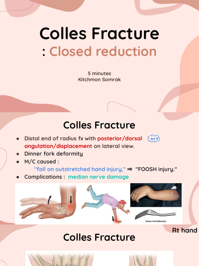 Colles FX | PDF