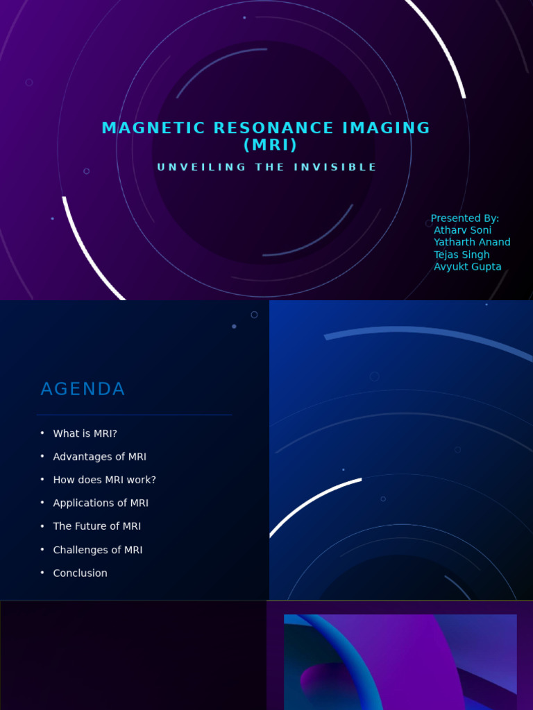MRI Presentation IX-D | PDF | Magnetic Resonance Imaging | Medical Imaging