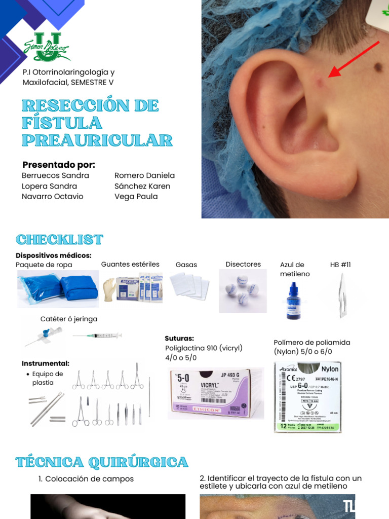 Fístula Preauricular | PDF
