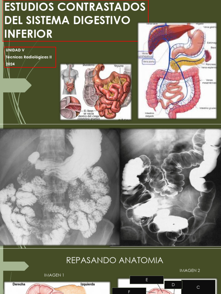 Estudios Contrastados Sistema Digestivo Inferior | PDF | Tracto ...