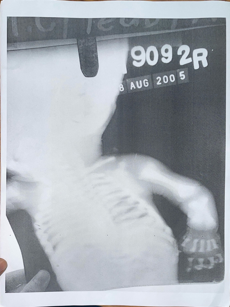 X Rays Paediatric | PDF