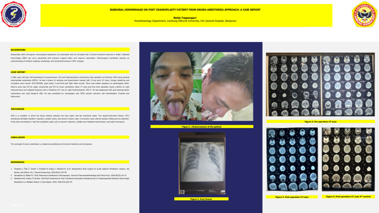 Subdural Hemorrhage On Post Cranioplasty Patient From Neuro-Anesthesia Approach A Case Report-2 ...