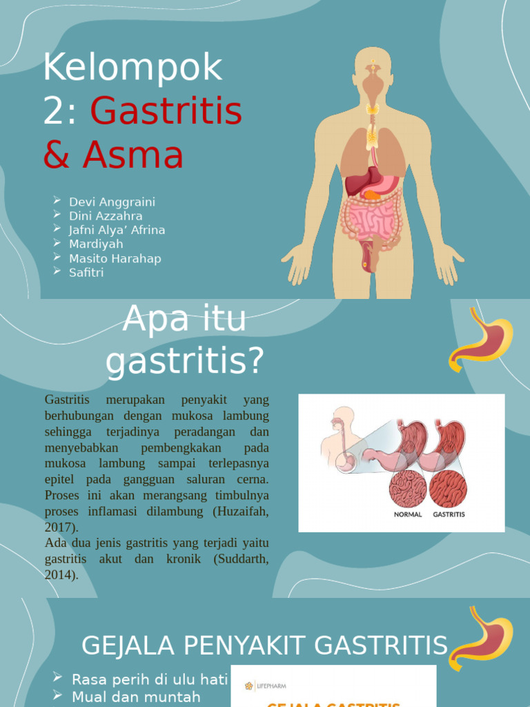 Ppt Gastritis_dan_Asma_Farmakoepidemiologi | PDF