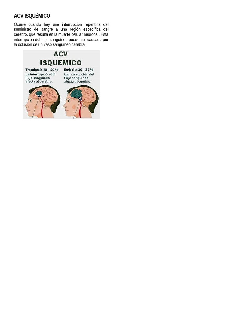 Acv Isquémico | PDF