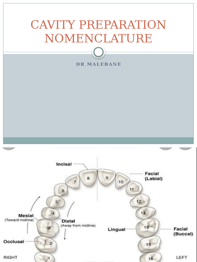 Cavity Prep Nomenclature | PDF