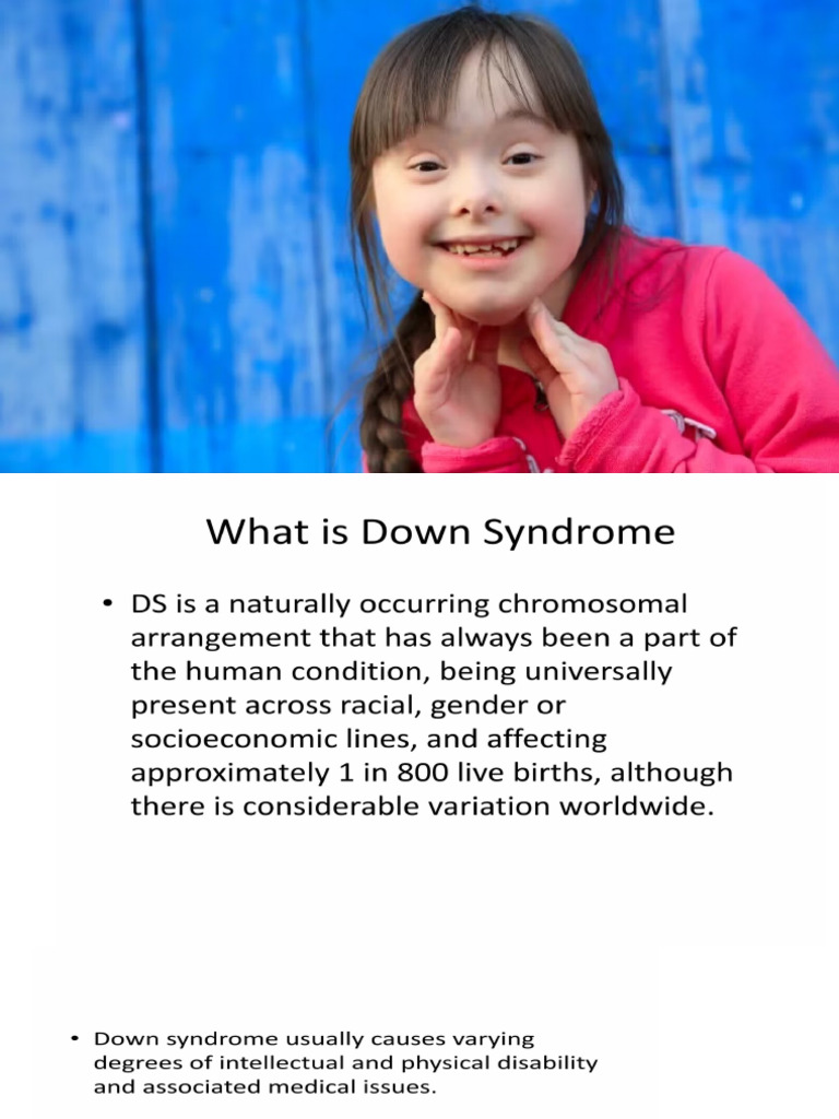 DOWN SYNDROME and Arnold Chairi Malformation and DWS | PDF | Diseases ...