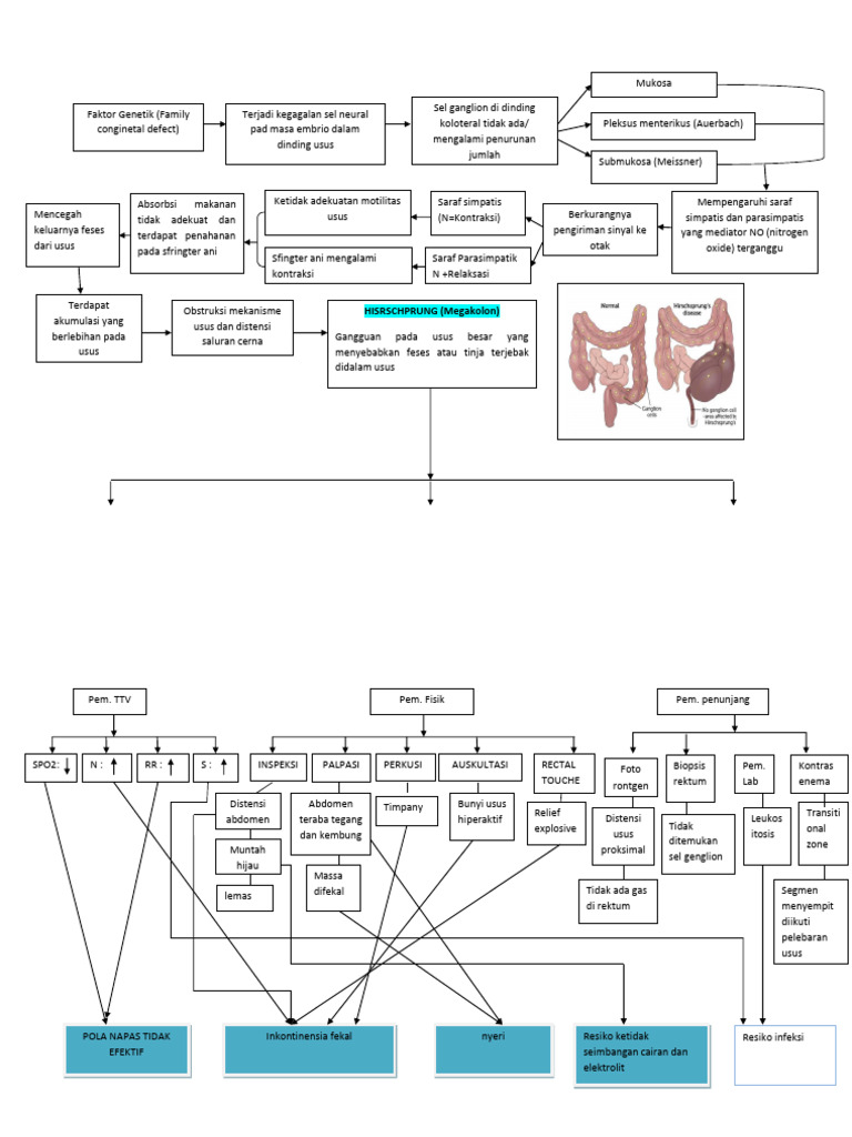 Pathway Hisprung | PDF