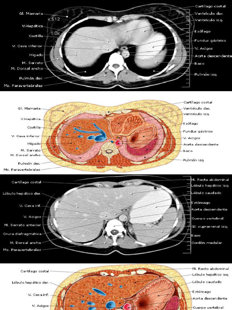 Abdomen Tac | PDF