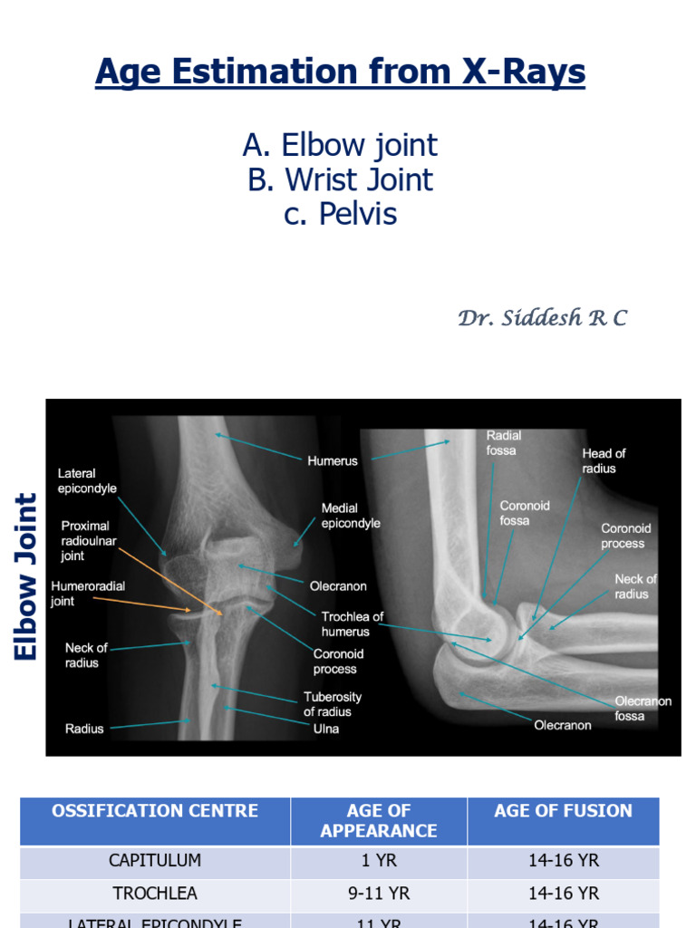 Age Estimation by X Rays | PDF | Pelvis | Human Anatomy