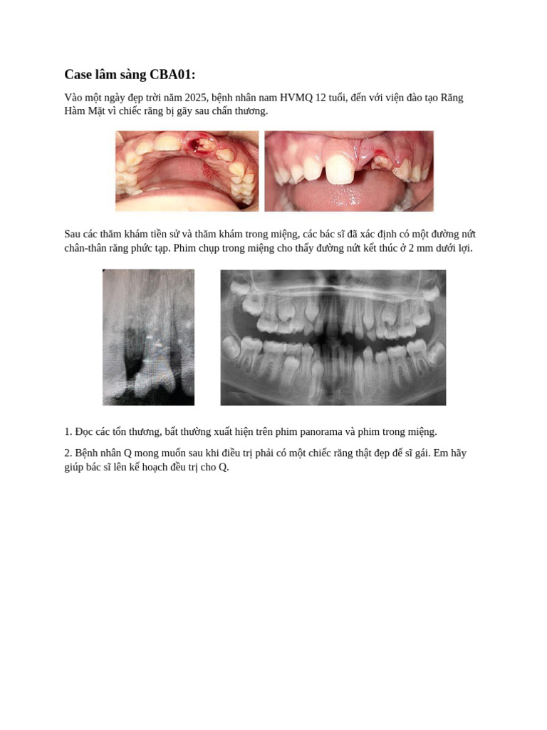 Case Lâm Sàng CBA01 | PDF