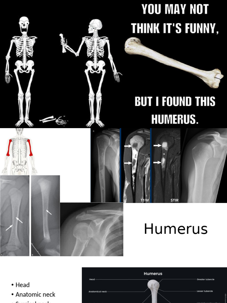 Radiology Humerus | PDF