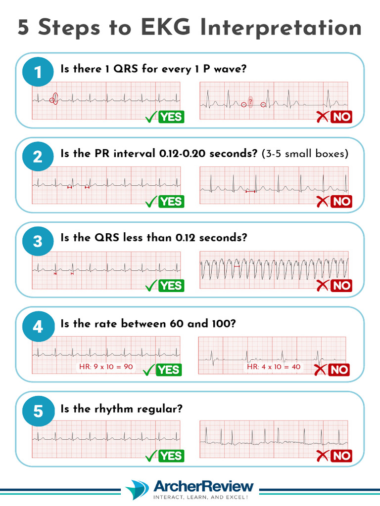 EKG Interpretation Checklist Guide | PDF