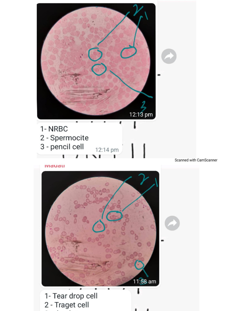 Patho practicals | PDF