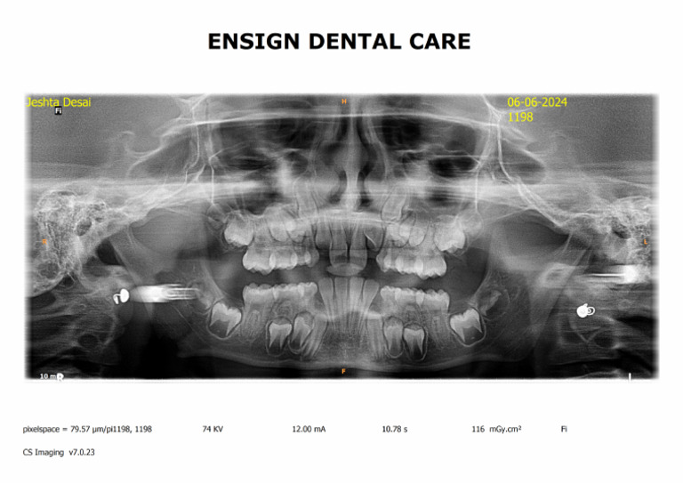 File of Teeth Disarrangement | PDF