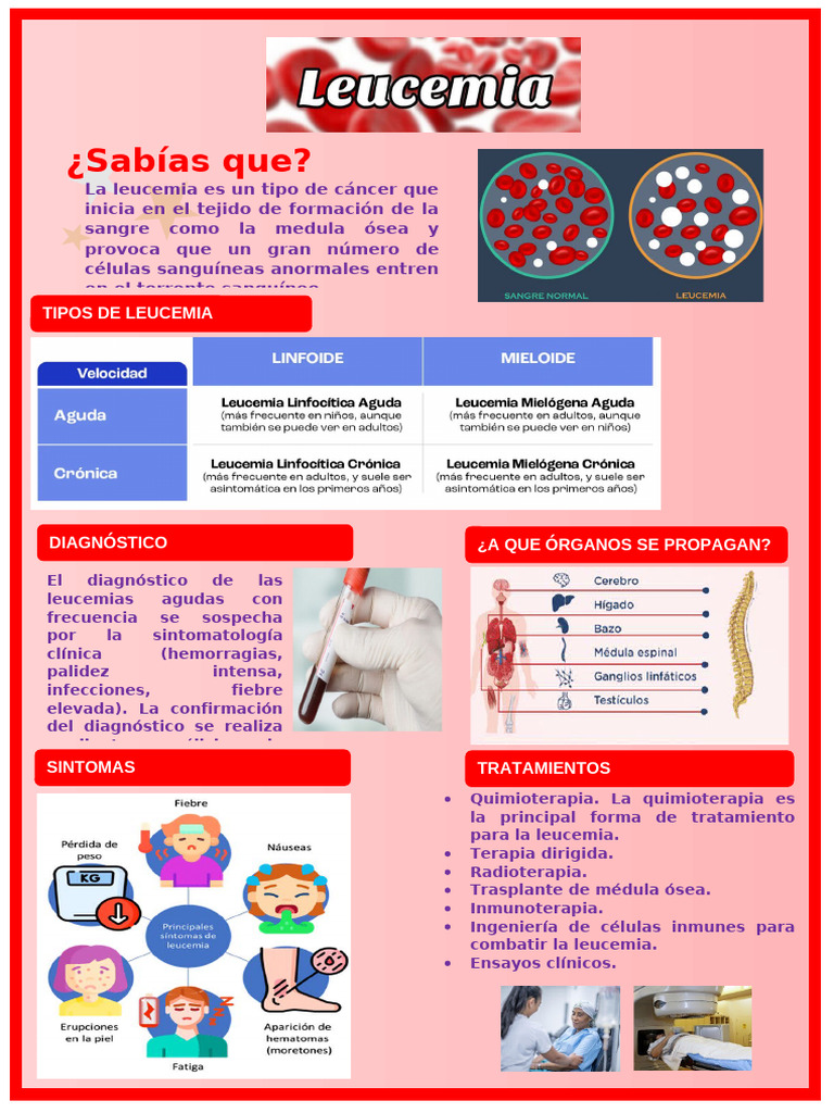INFOGRAFIA La Leucemia | PDF