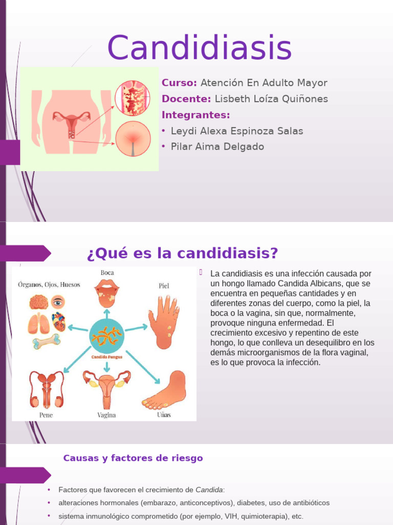 Candidiasis: Causas, Síntomas y Tratamiento | PDF | Candidiasis ...